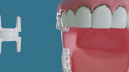 2025 Top Rated Water Flossers for Effective & Painless Cleaning: Get a ...